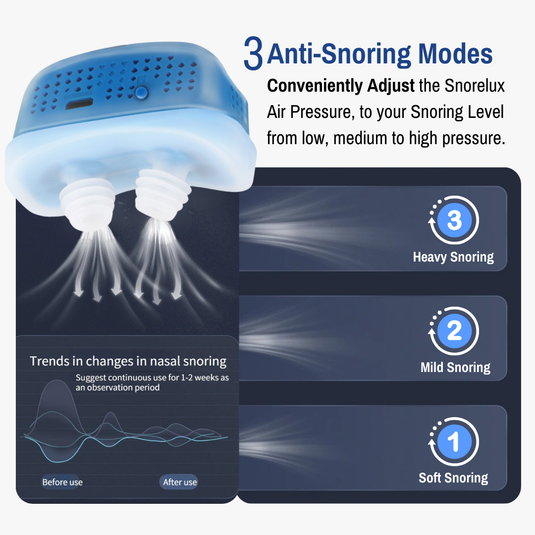 Advanced Electric Anti-Snoring Device – Snorelux®